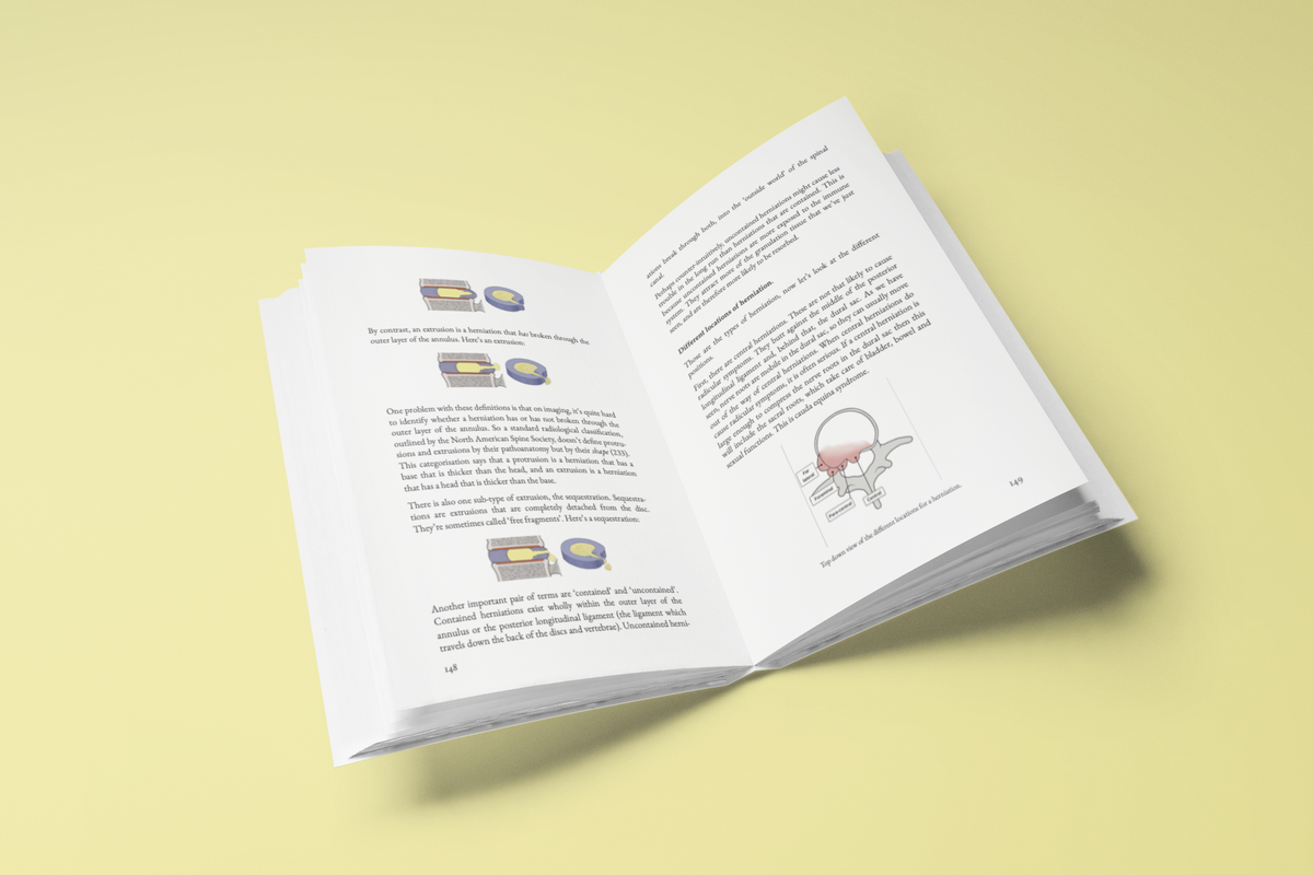 Understanding Sciatica – Tom Jesson Books