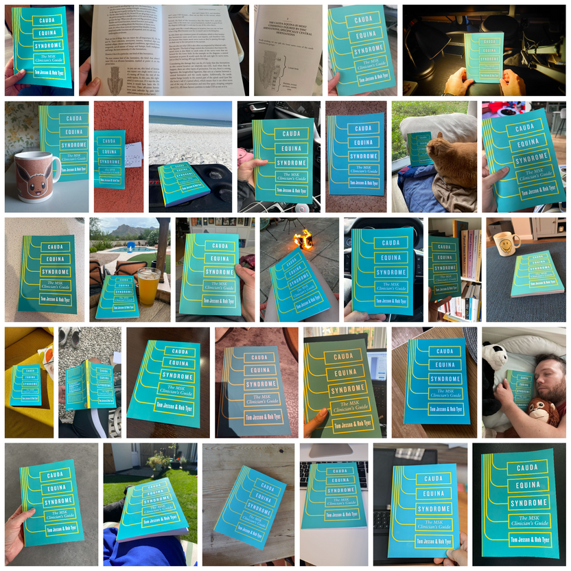 Cauda Equina Syndrome: The MSK Clinician's Guide – Tom Jesson Books